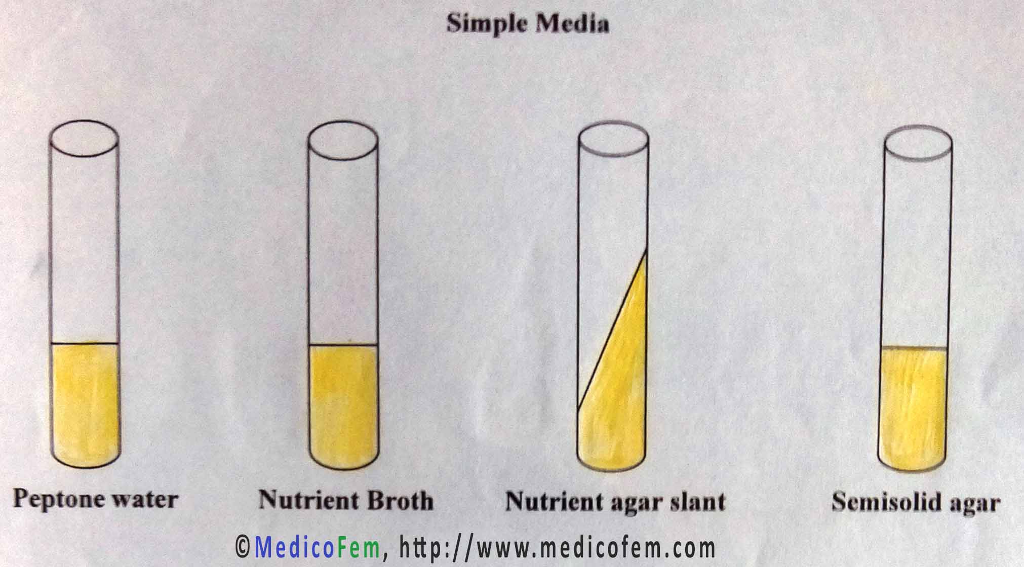 Are broth solid media?