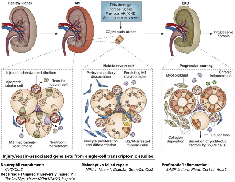 Can a damaged kidney regenerate?