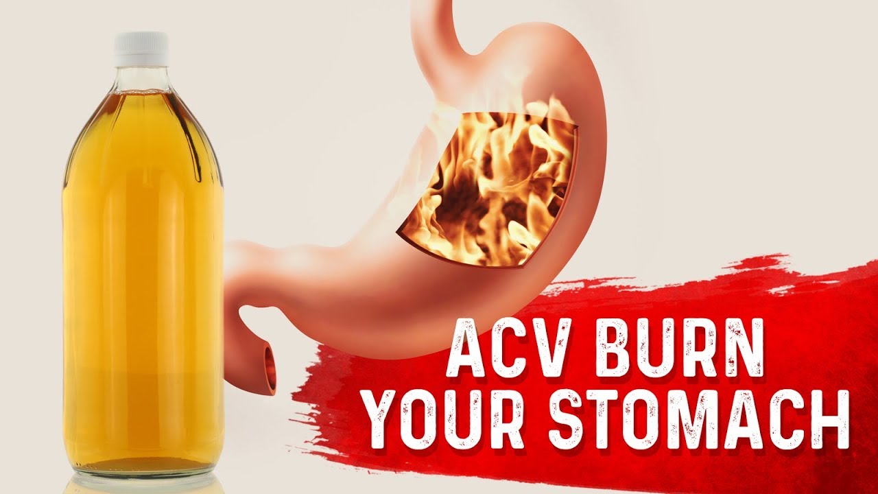 Can apple cider vinegar burn your insides?