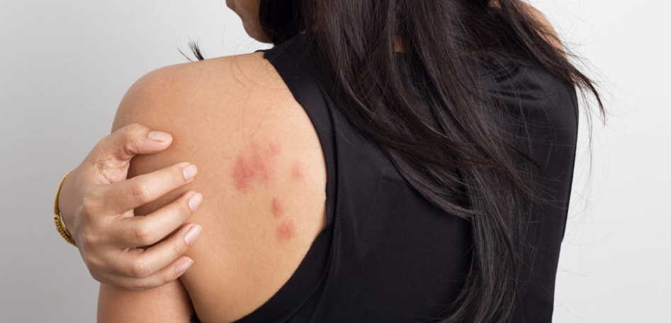 Can collagen cause bumps on skin?