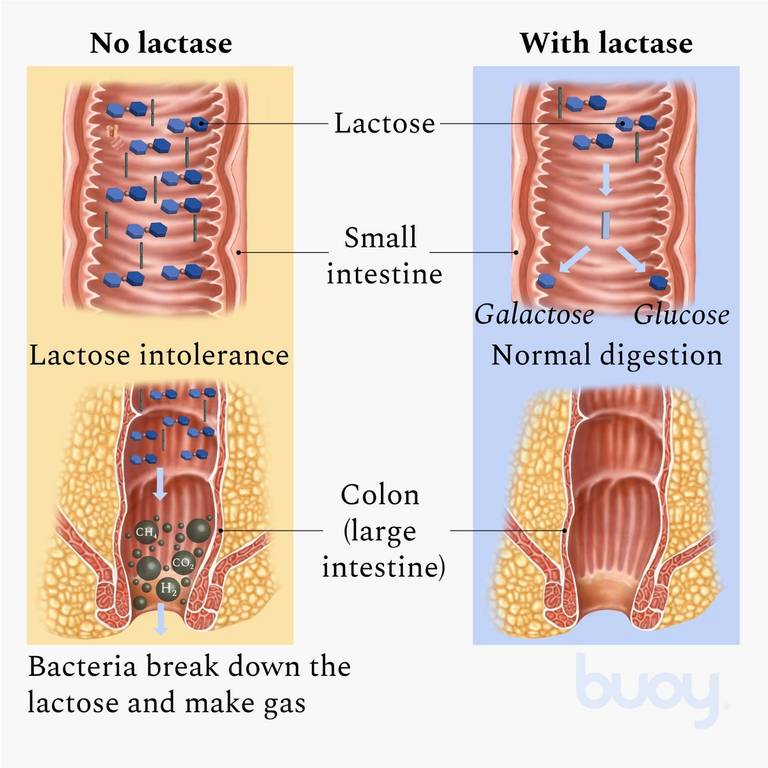 Can dairy damage your intestines?