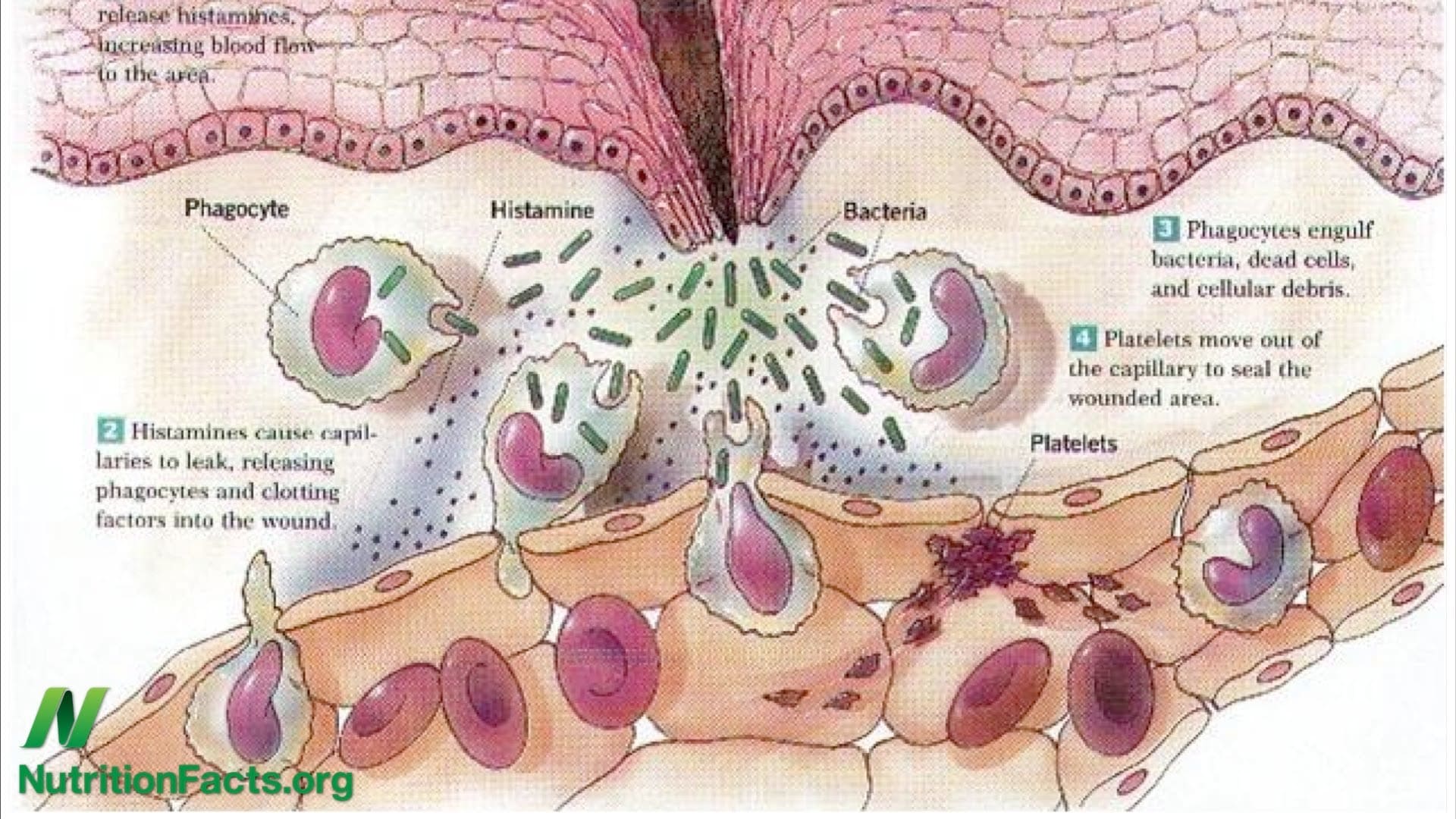 Can eggs cause inflammation?