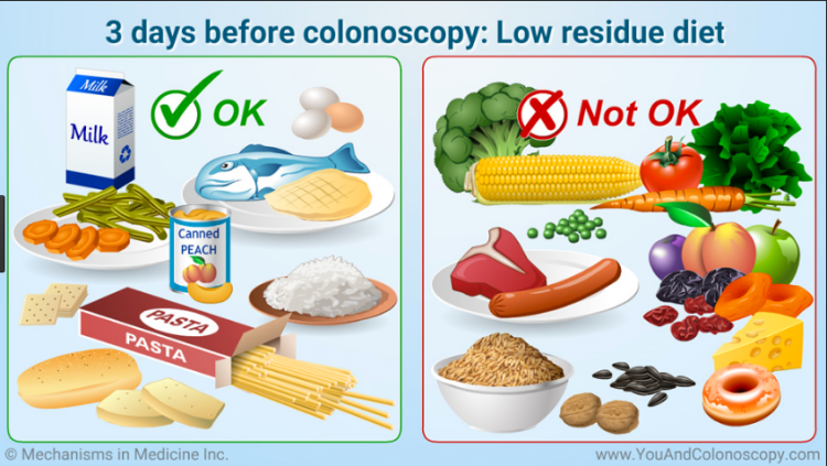Can I eat a low-residue diet the day before my colonoscopy?