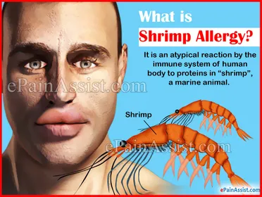 Can you develop an allergy to prawns?