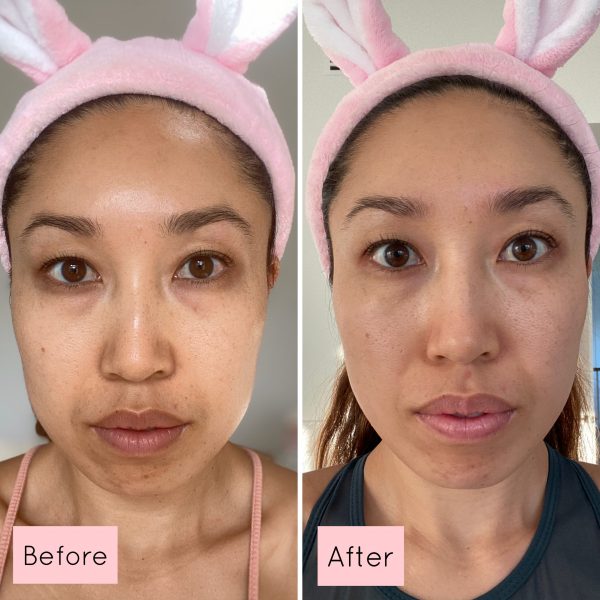 Do face slimming exercises work?