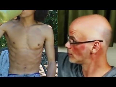 Do vegans become malnourished?