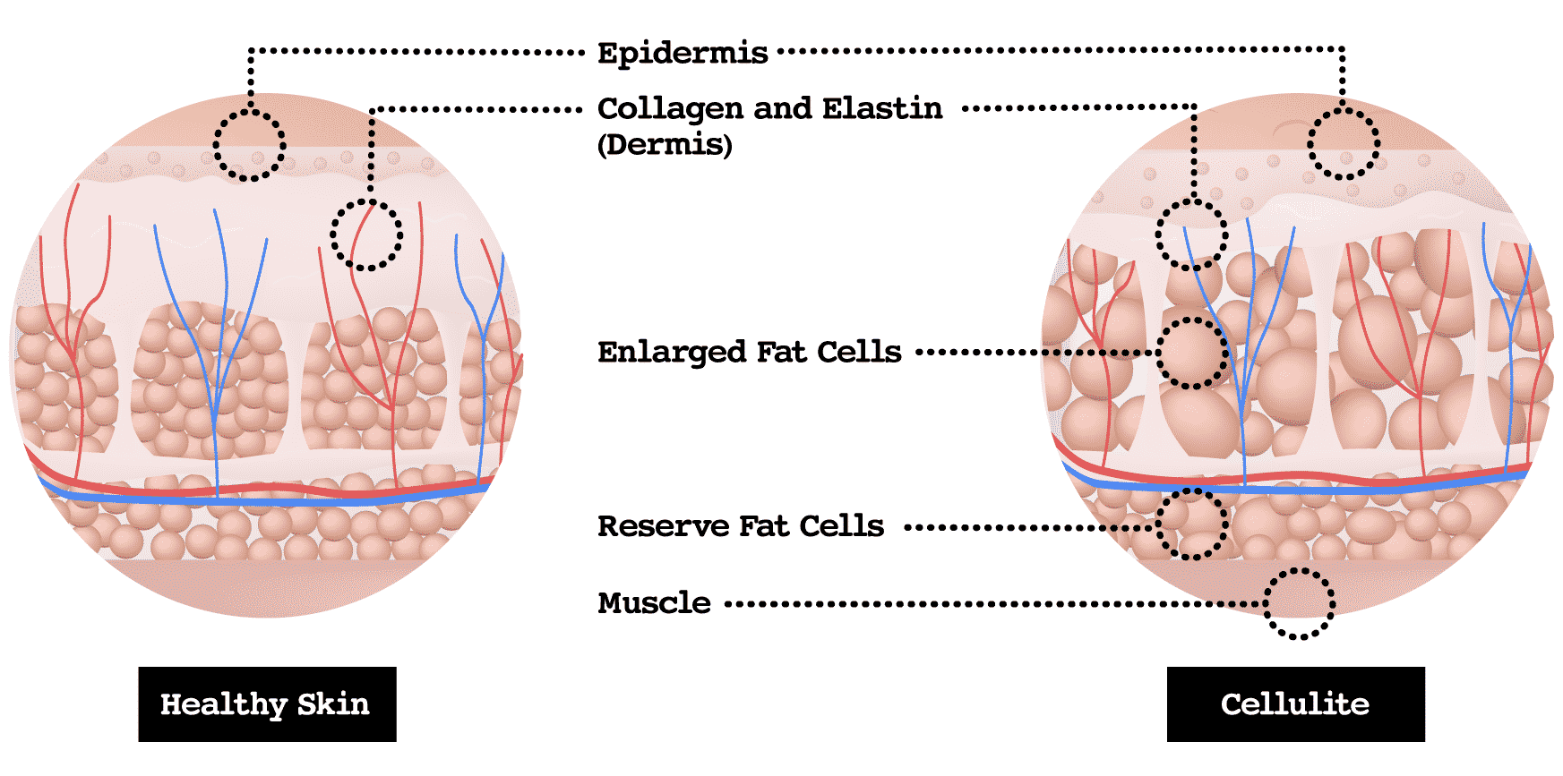 Does collagen make you gain weight?
