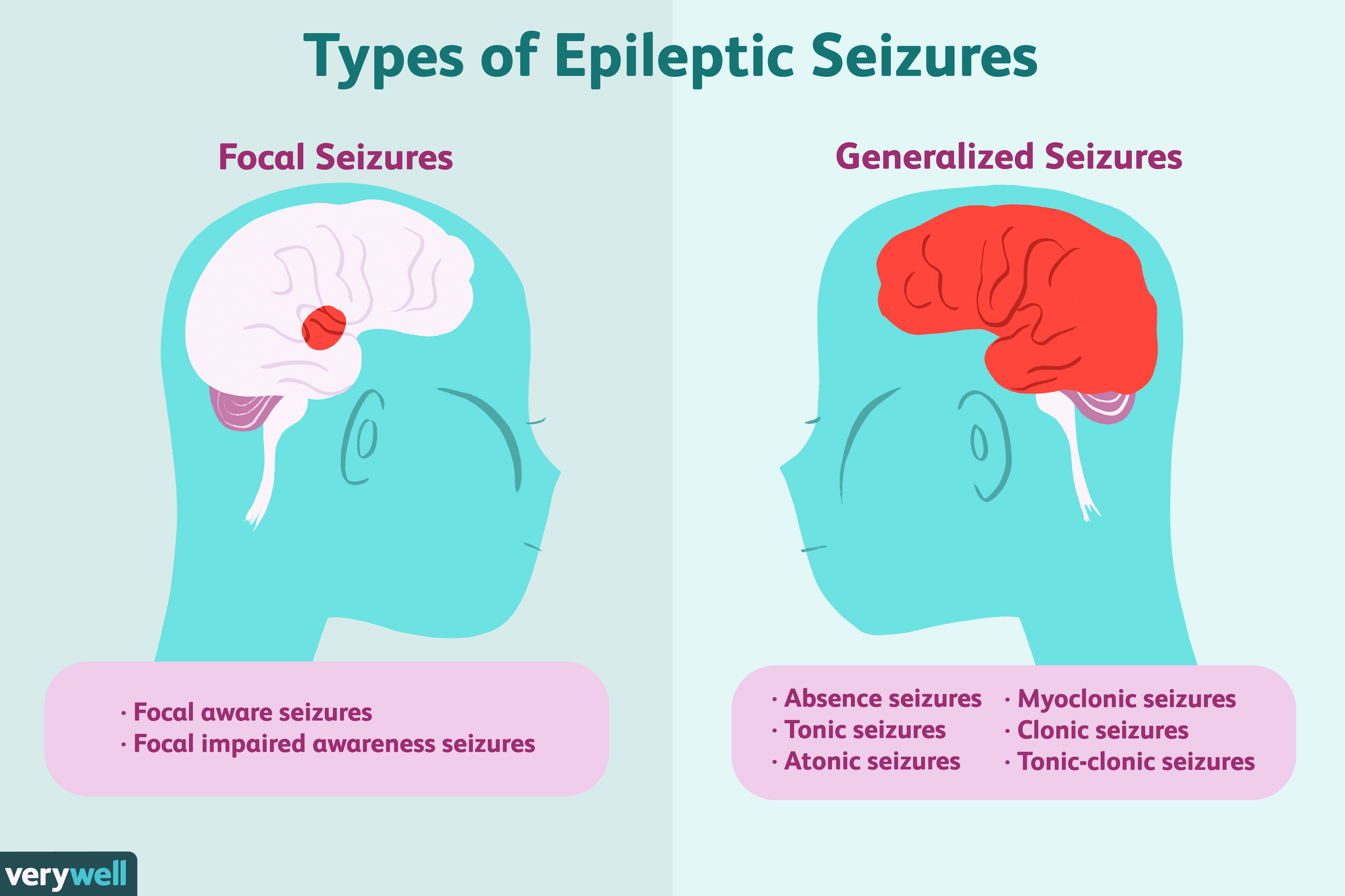 Does epilepsy have another name?