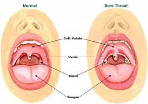 Does salt water irritate a sore throat?