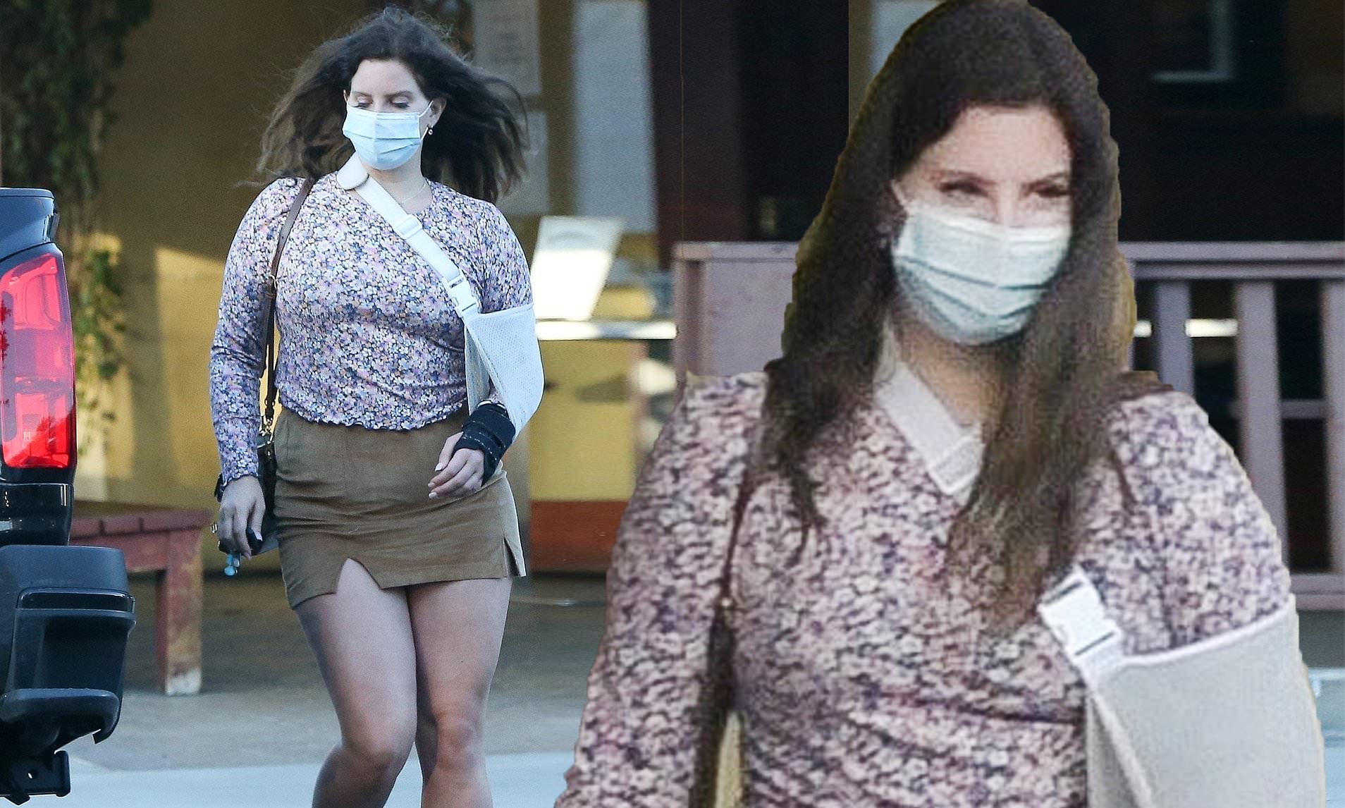 How did Lana Del Rey hurt her arm?