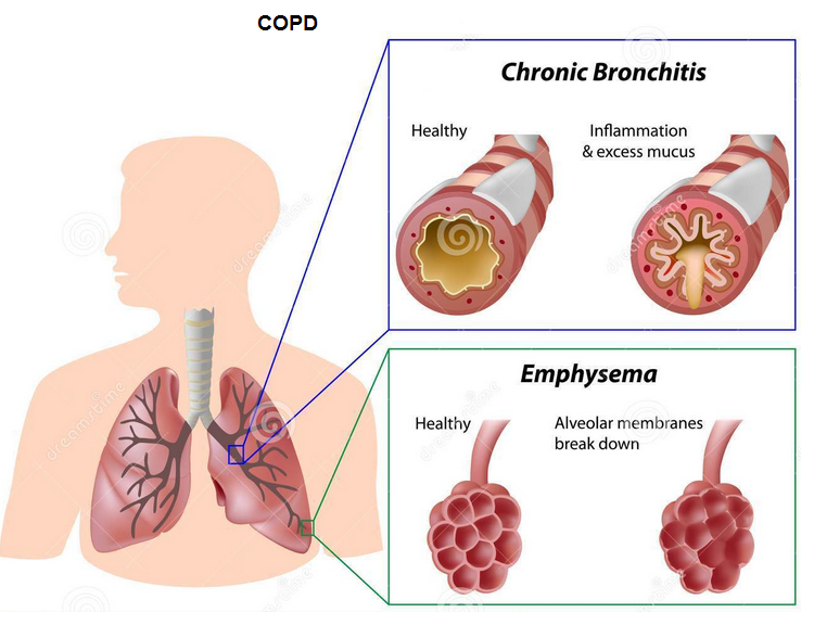 How does smoking cigarettes interfere with gas exchange and damage the respiratory system?