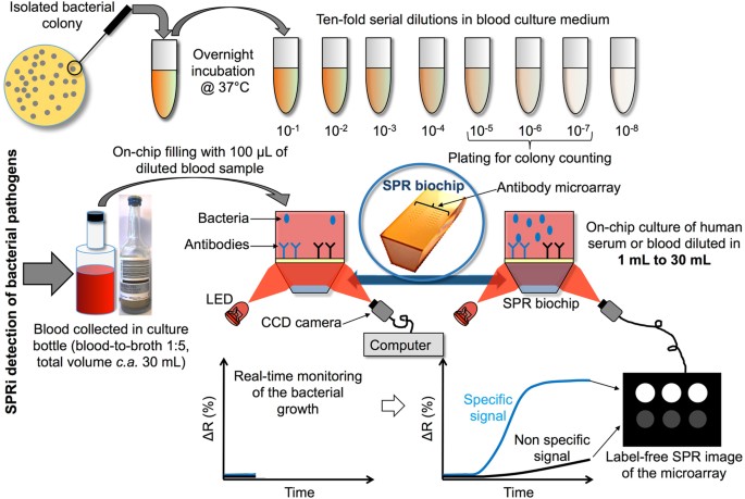 How is bacterial growth detected in a broth medium?