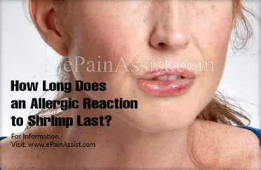 How long do allergic reactions to shrimp last?