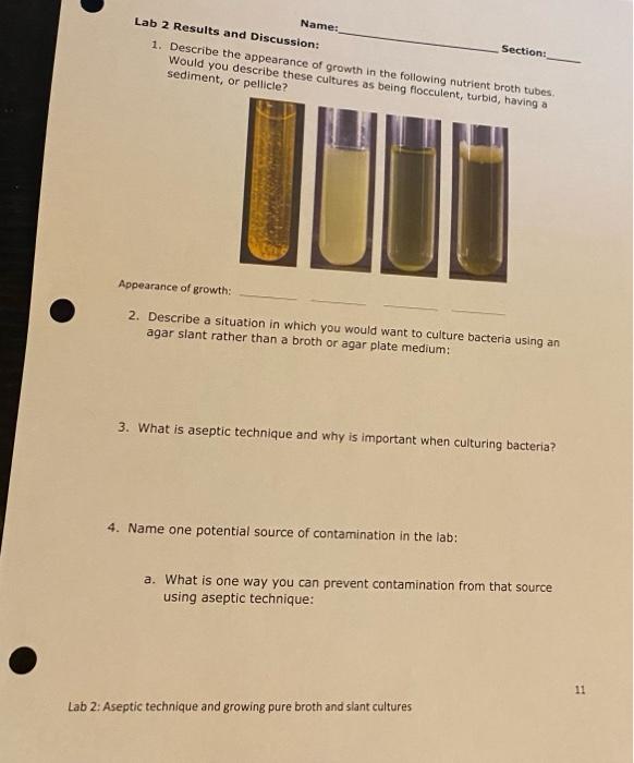 How would you be able to tell if the growth in a broth is a pure culture or if it is contaminated?