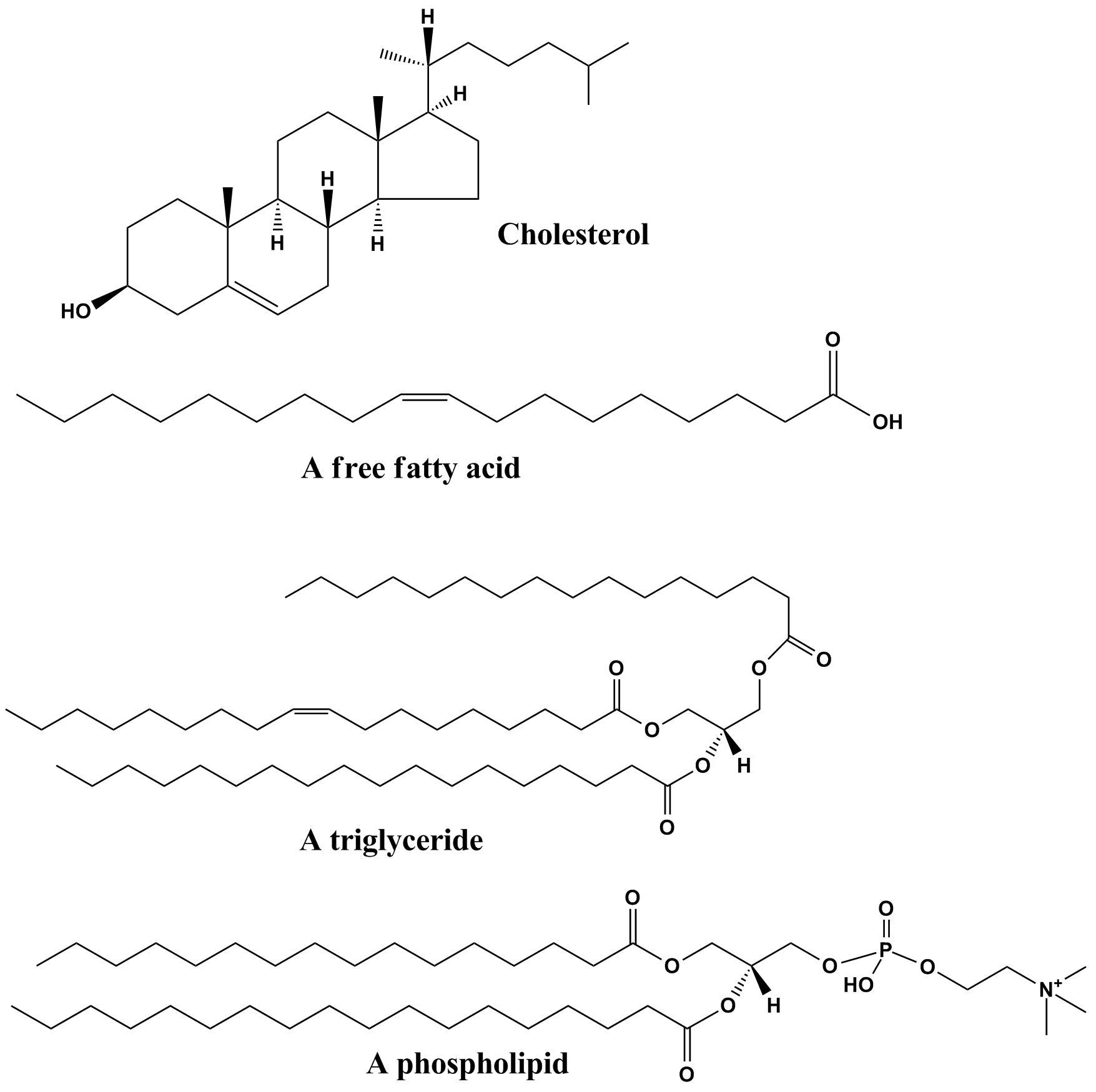 Is a cholesterol lipid?