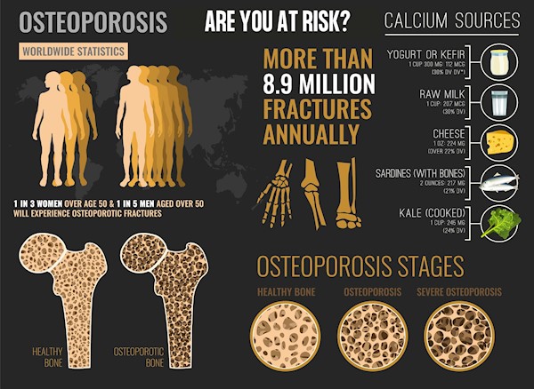 Is it too late to build bone density?