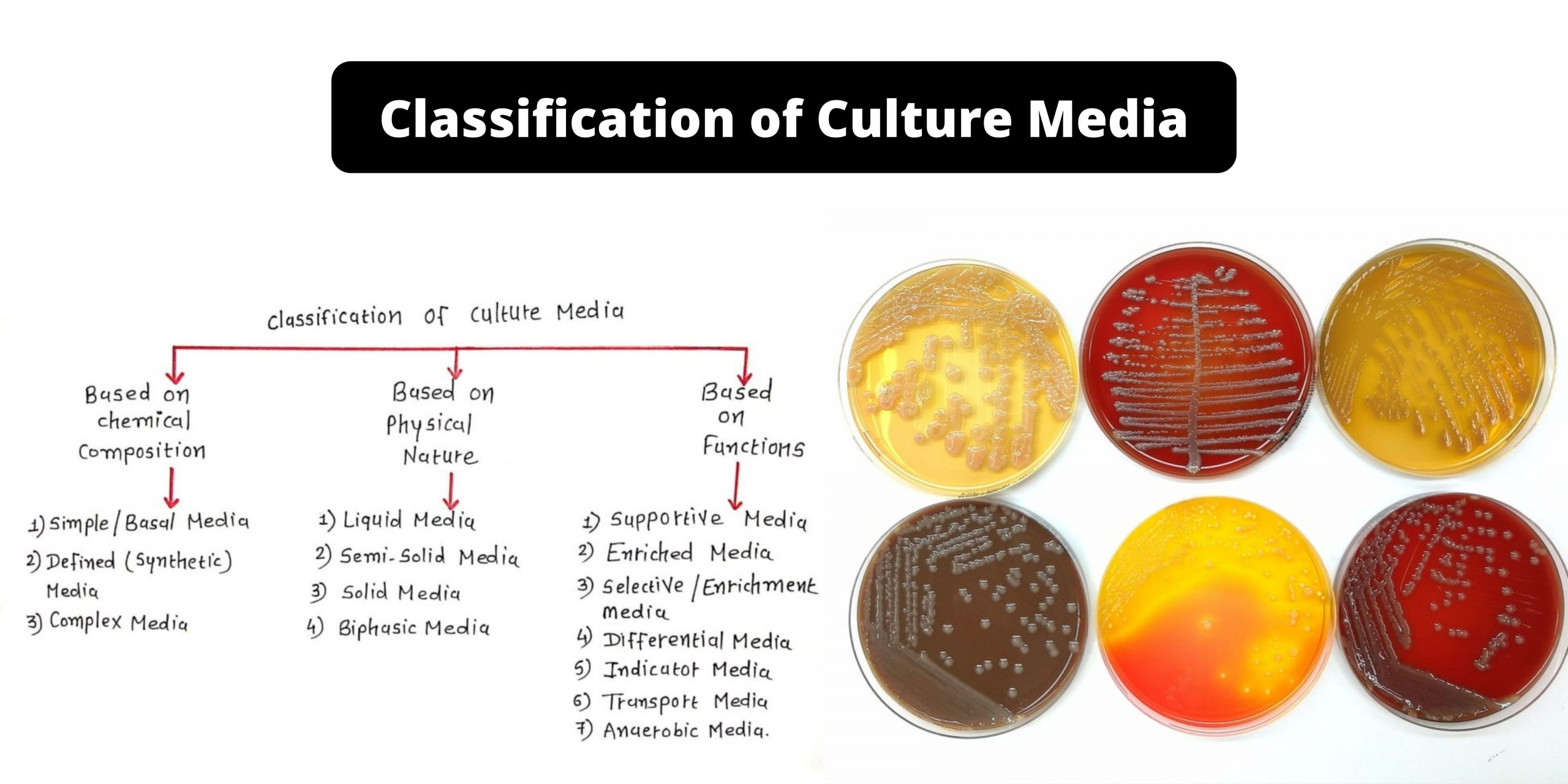 What are the classifications of culture media?