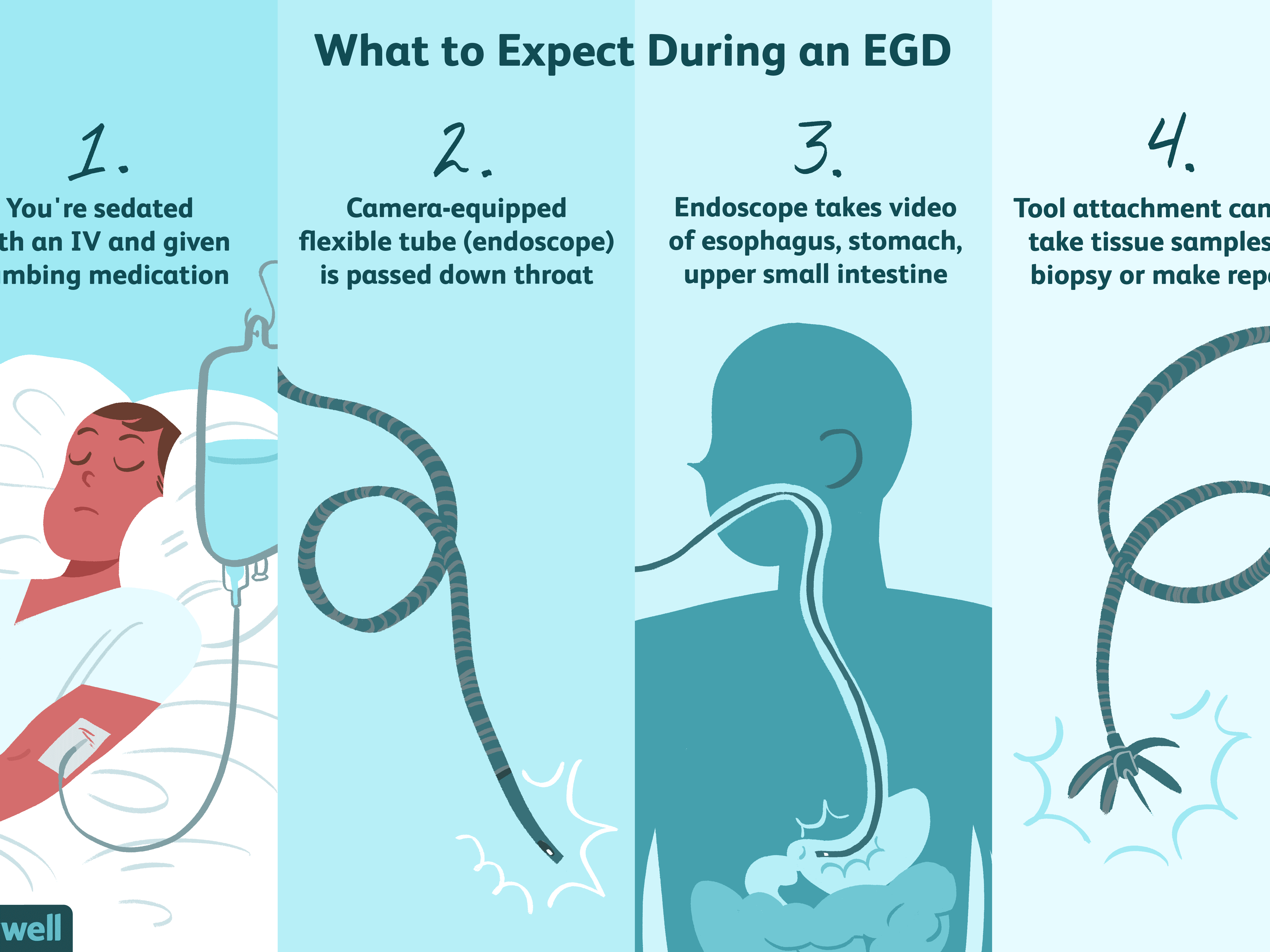 What are the side effects of an endoscopy?
