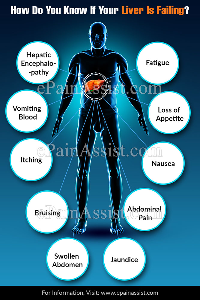 What does it feel like when your liver is failing?