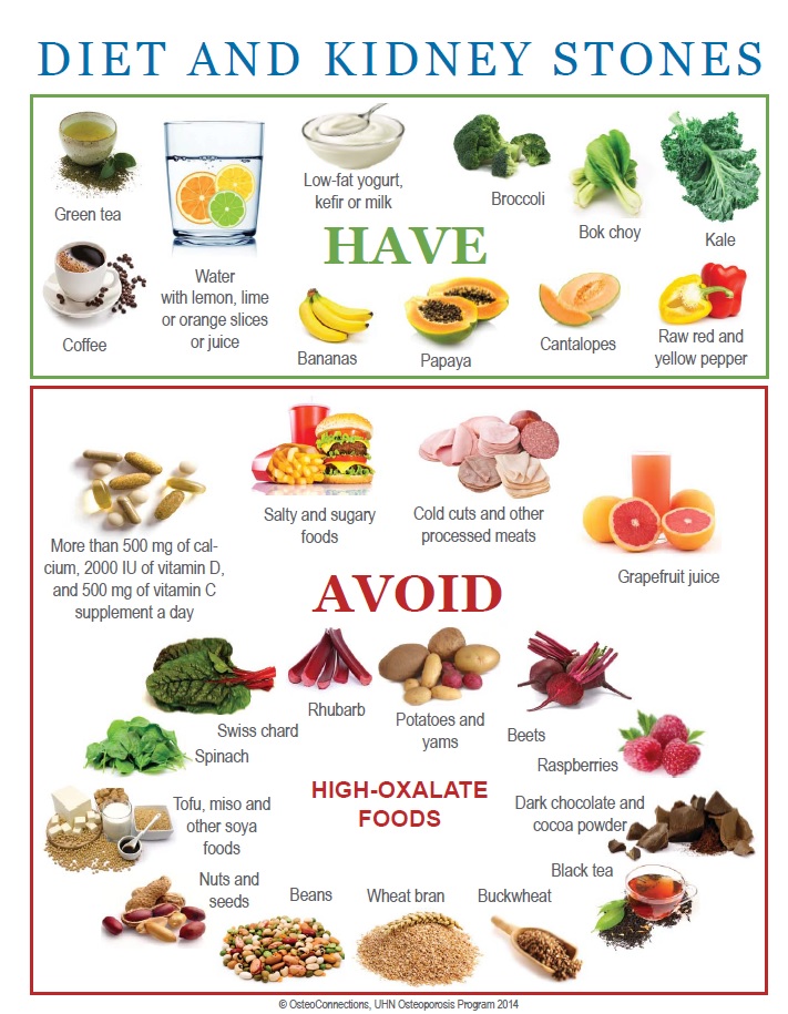 What food should be avoided for kidney stones?