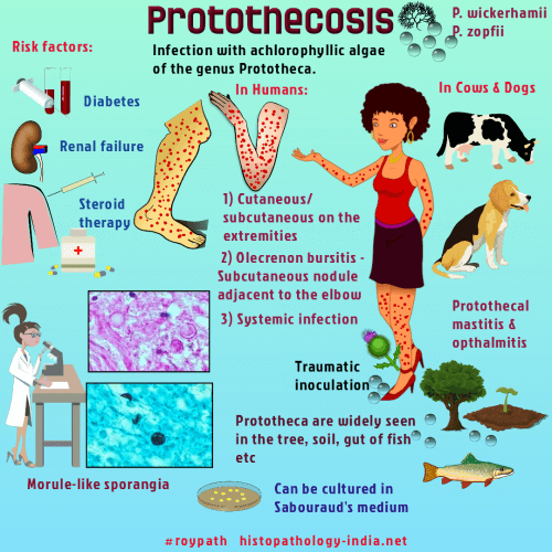 What infection is caused by algae?