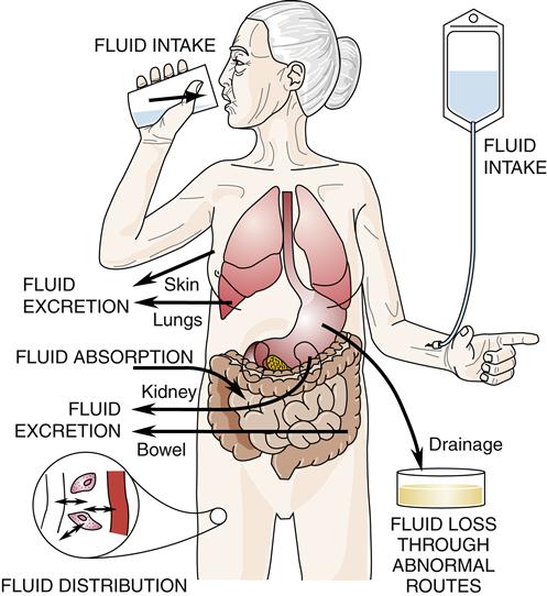 What is abnormal fluid loss?
