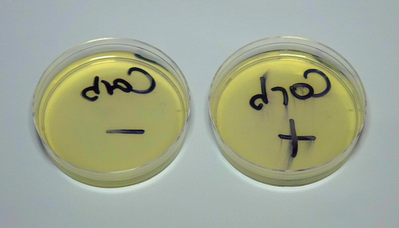 What is an LB plate biology?