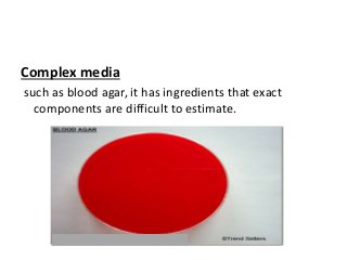 What is complex culture media?