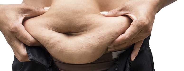 What is diabetic belly?