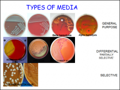 What is general media in microbiology?