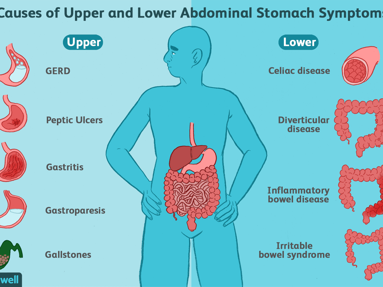What is stomach gurgling a symptom of?