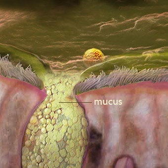 What is the main cause of mucus?