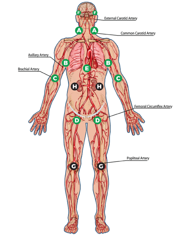 When should you not do cupping?