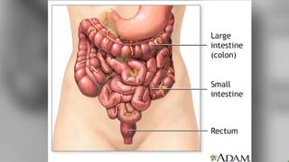 Why do some farts smell worse?