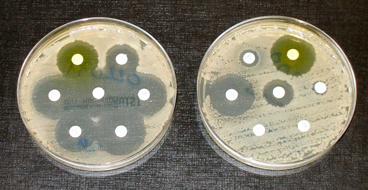 Why do we culturing bacteria?